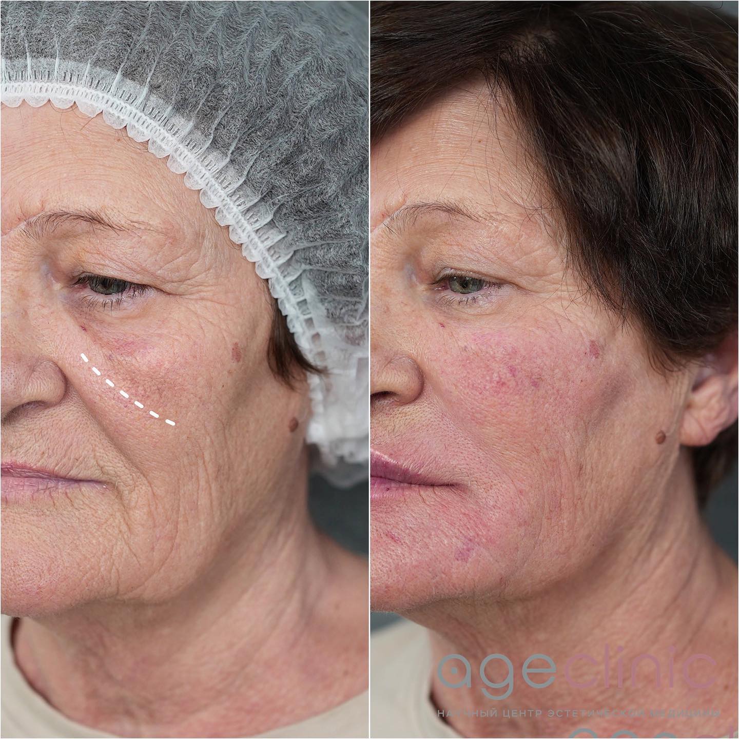 Клиника эстетической медицины и косметологии в Москве | Age Clinic
